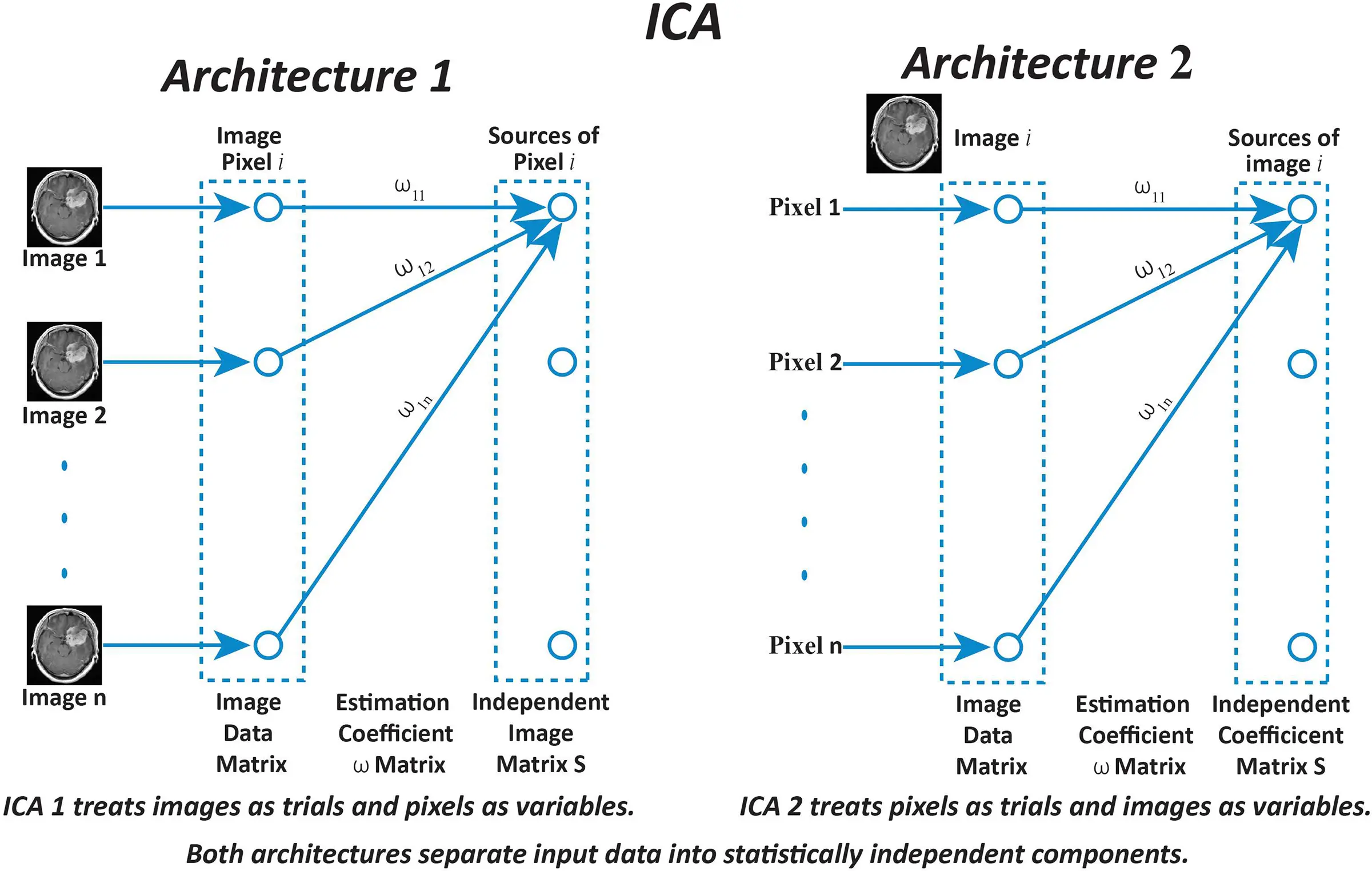 CMES | Free Full-Text | Advanced Computational Modeling for Brain Tumor ...