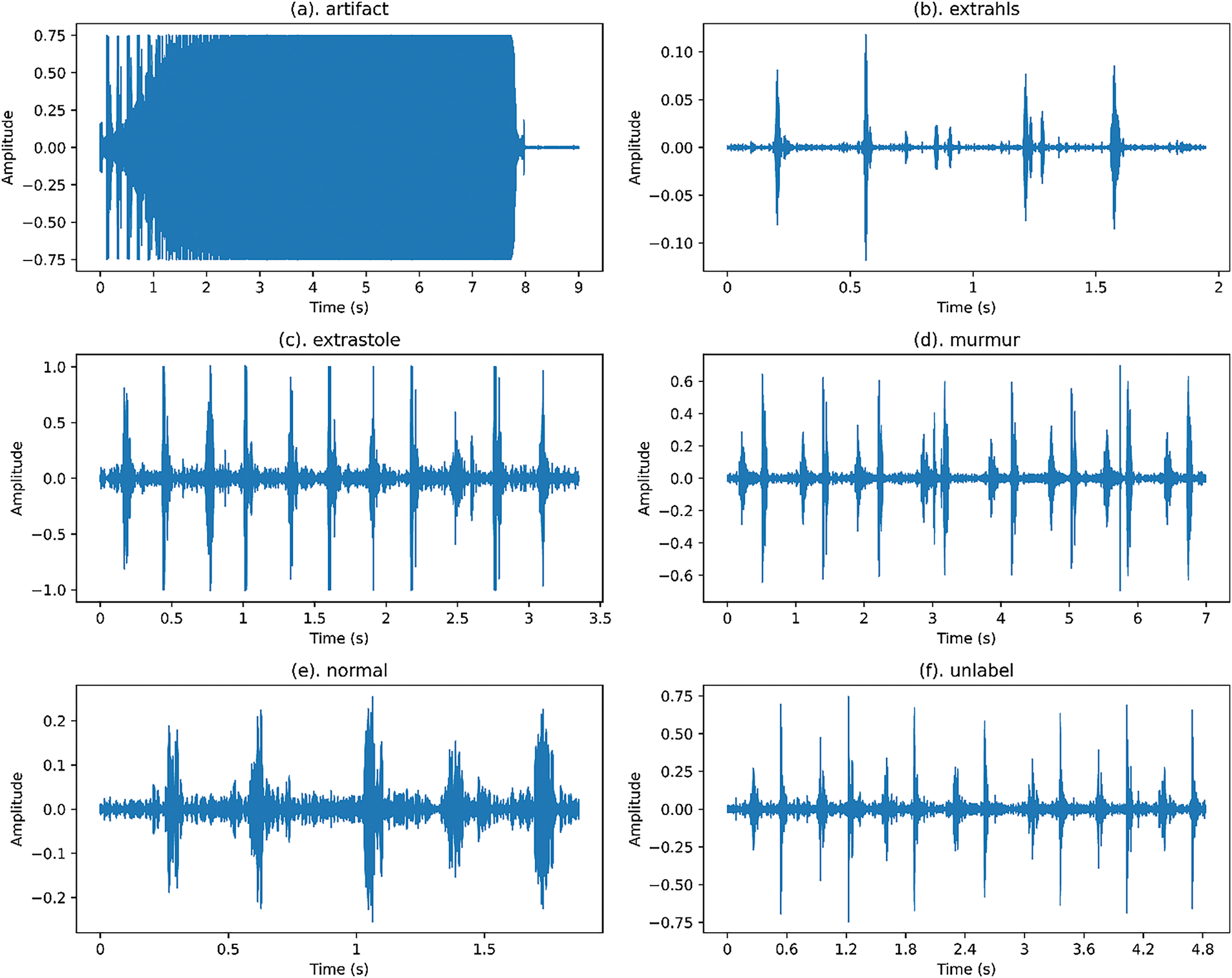CMES | Free Full-Text | Cardiovascular Sound Classification Using Neural Architectures and Deep ...