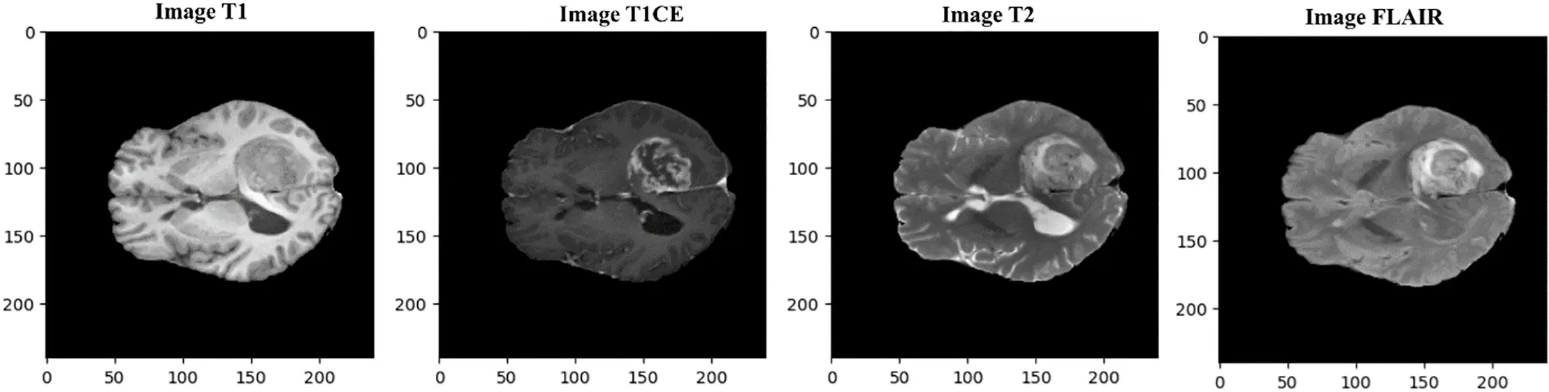 CMES | Free Full-Text | Enhancing 3D U-Net with Residual and Squeeze ...