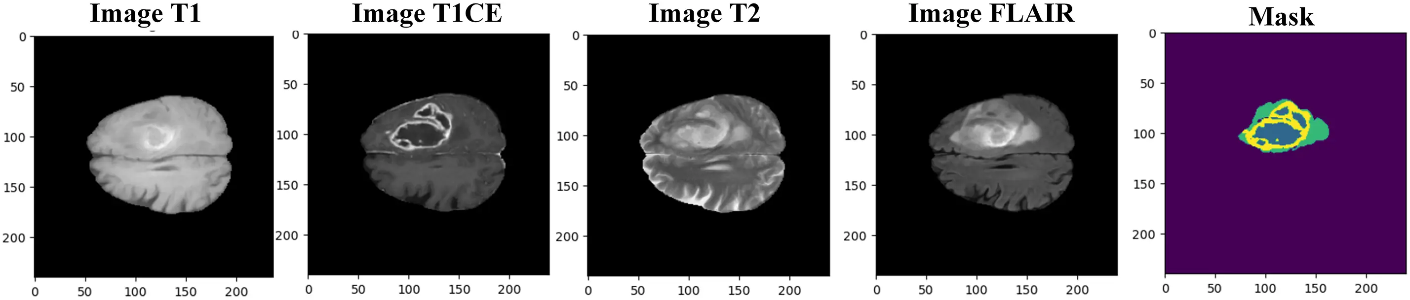 CMES | Free Full-Text | Enhancing 3D U-Net with Residual and Squeeze-and-Excitation Attention ...