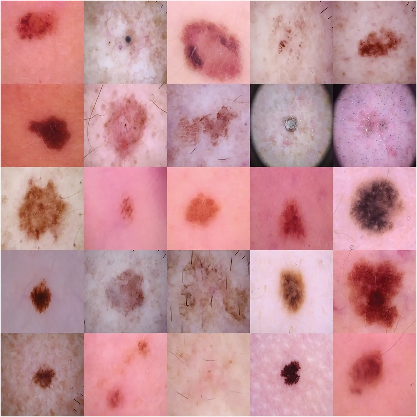 CMES | Free Full-Text | Robust Skin Cancer Detection through CNN ...