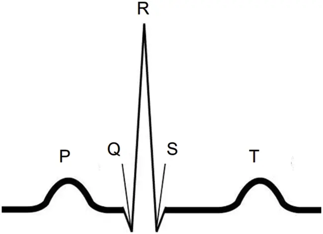 CMC | Free Full-Text | TinyML-Based Classification in an ECG Monitoring Embedded System