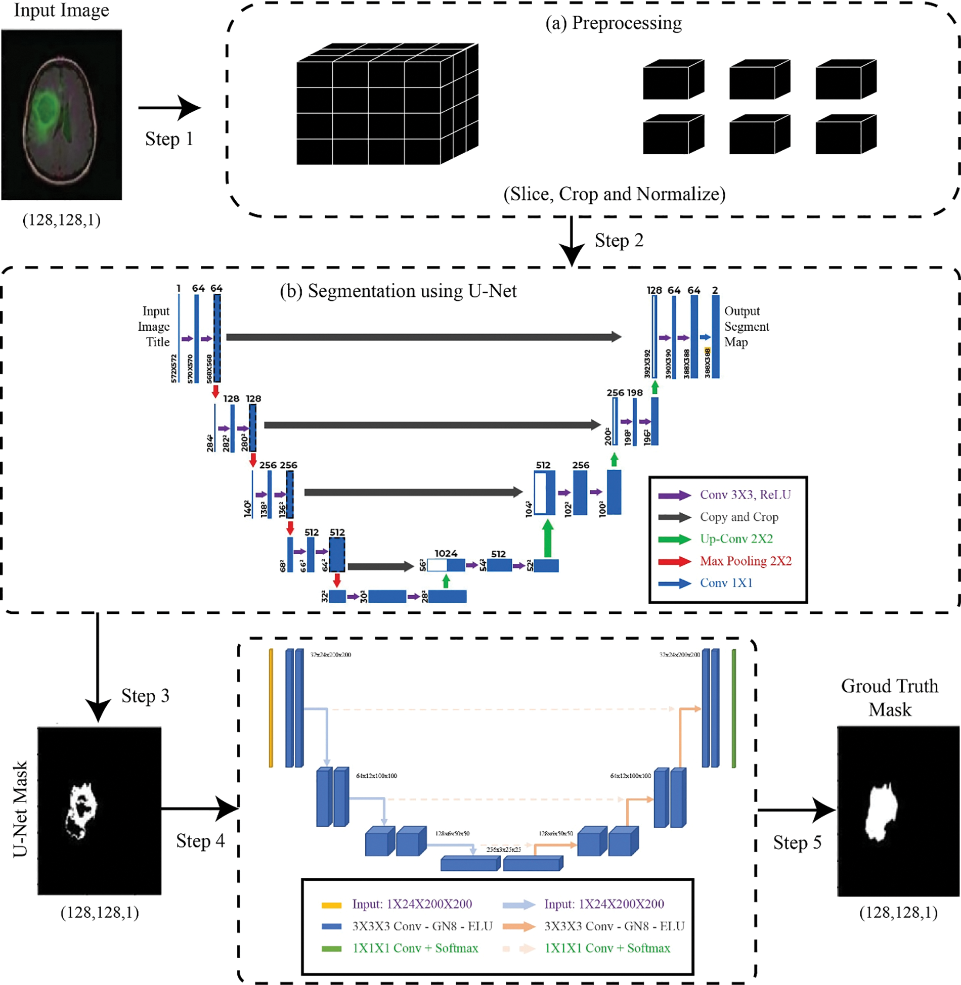 CMC | Free Full-Text | Intelligent Machine Learning Based Brain Tumor Segmentation through Multi ...