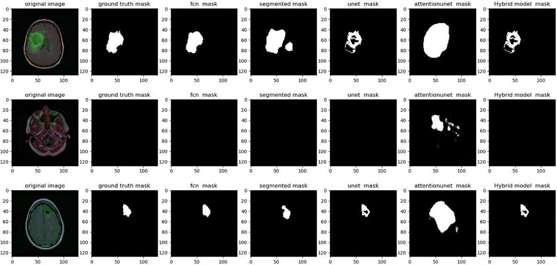 CMC | Free Full-Text | Intelligent Machine Learning Based Brain Tumor Segmentation through Multi ...