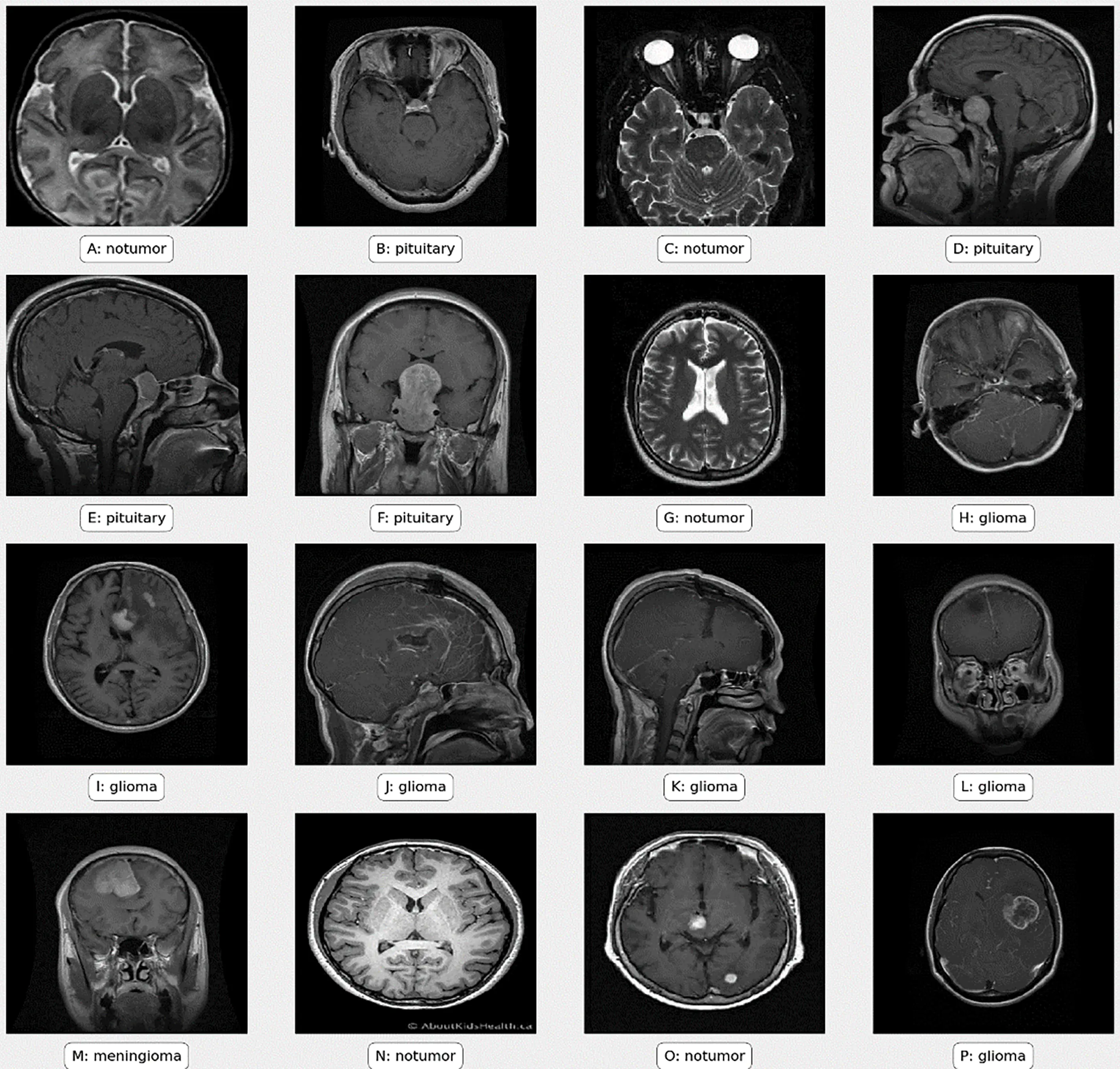 CMC | Free Full-Text | Leveraging EfficientNetB3 in a Deep Learning Framework for High-Accuracy ...