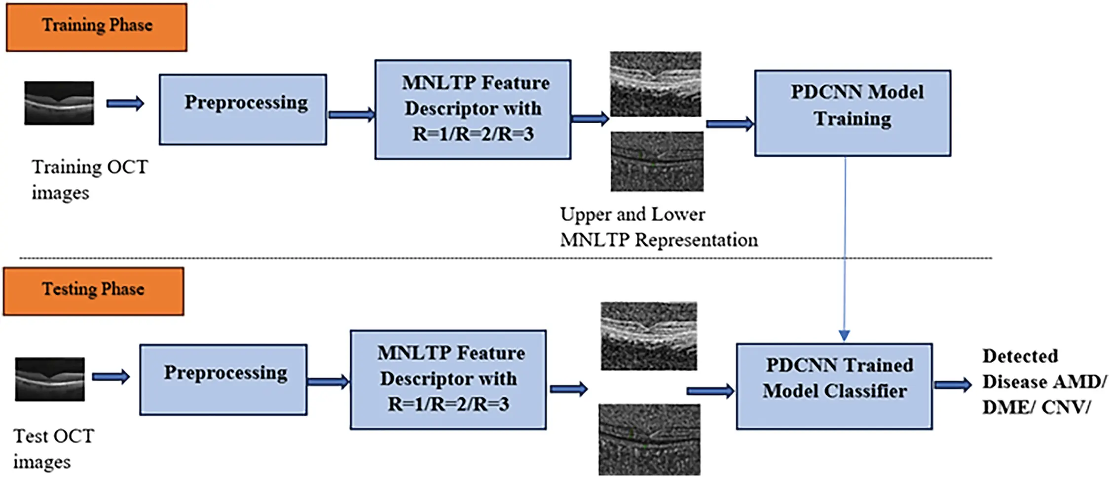 CMC | Free Full-Text | Hybrid MNLTP Texture Descriptor and PDCNN-Based OCT Image Classification ...