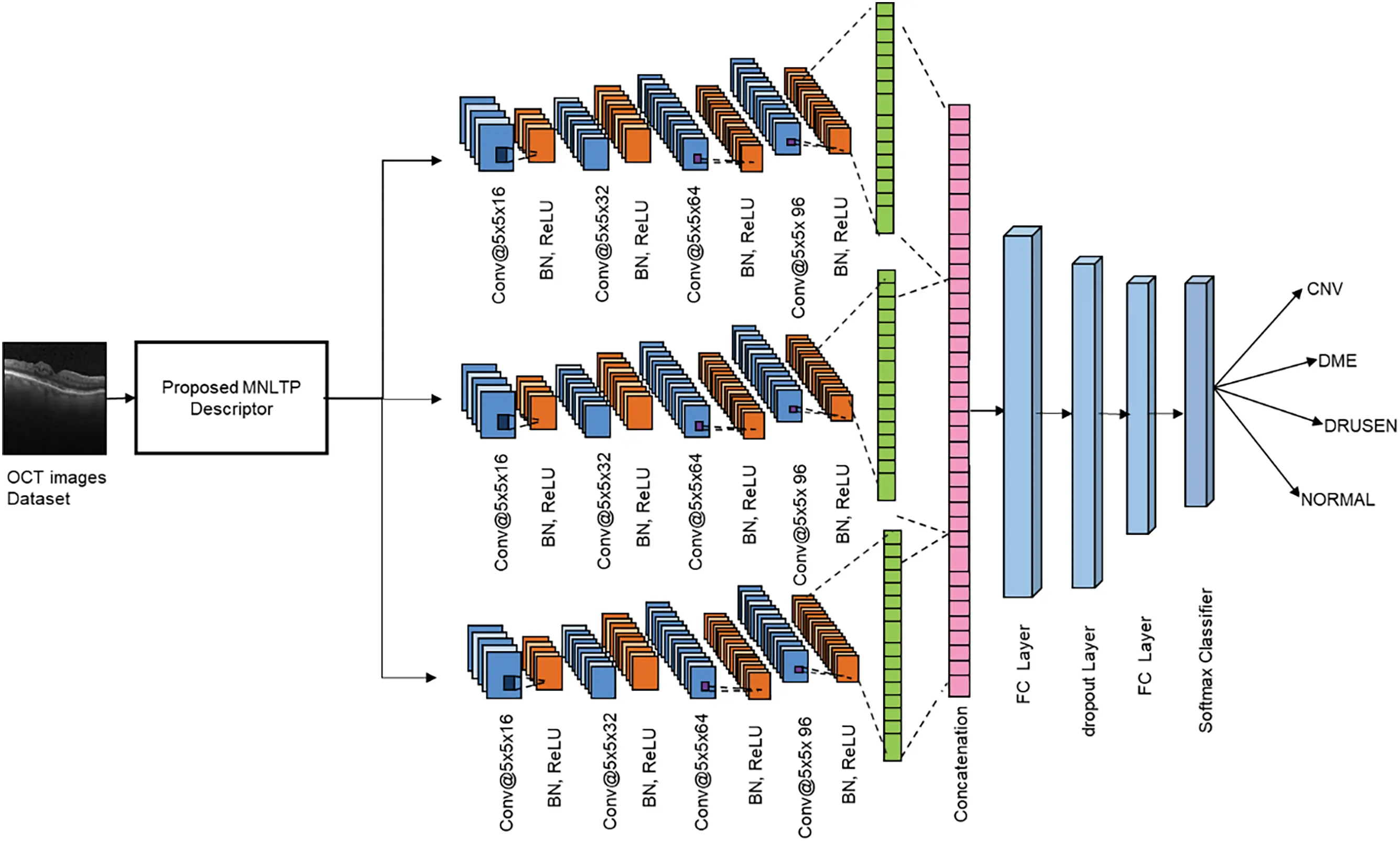 CMC | Free Full-Text | Hybrid MNLTP Texture Descriptor and PDCNN-Based OCT Image Classification ...