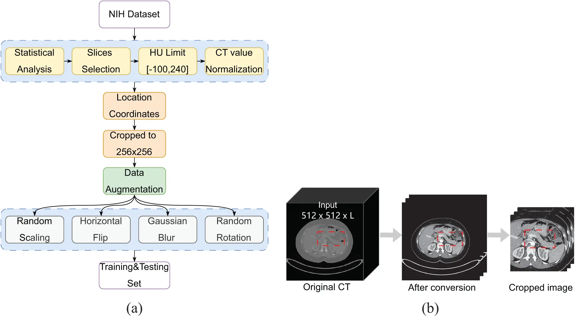 CMC | Free Full-Text | Automatic Pancreas Segmentation in CT Images Using EfficientNetV2 and ...