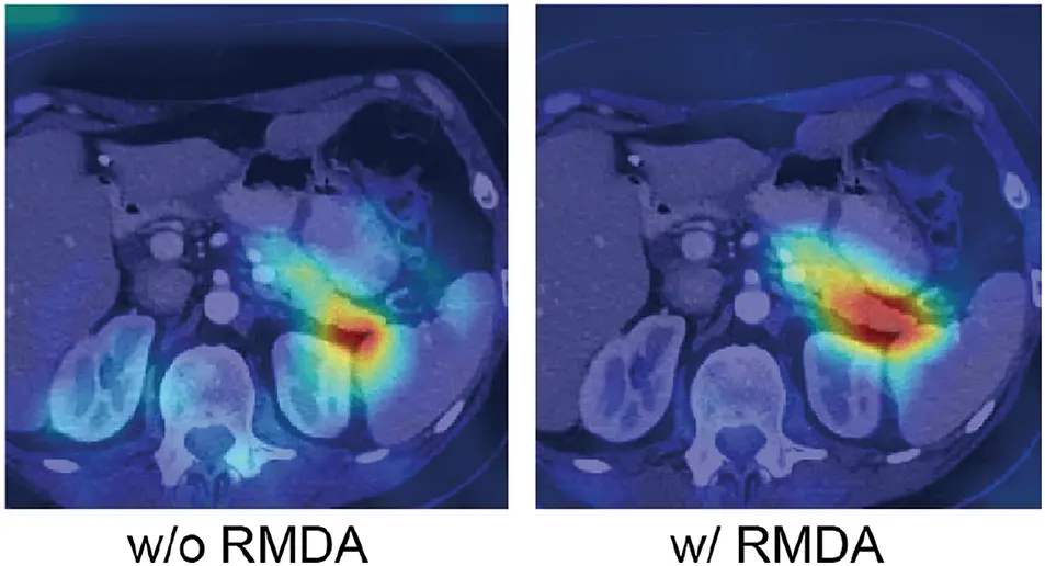 CMC | Free Full-Text | Automatic Pancreas Segmentation in CT Images ...