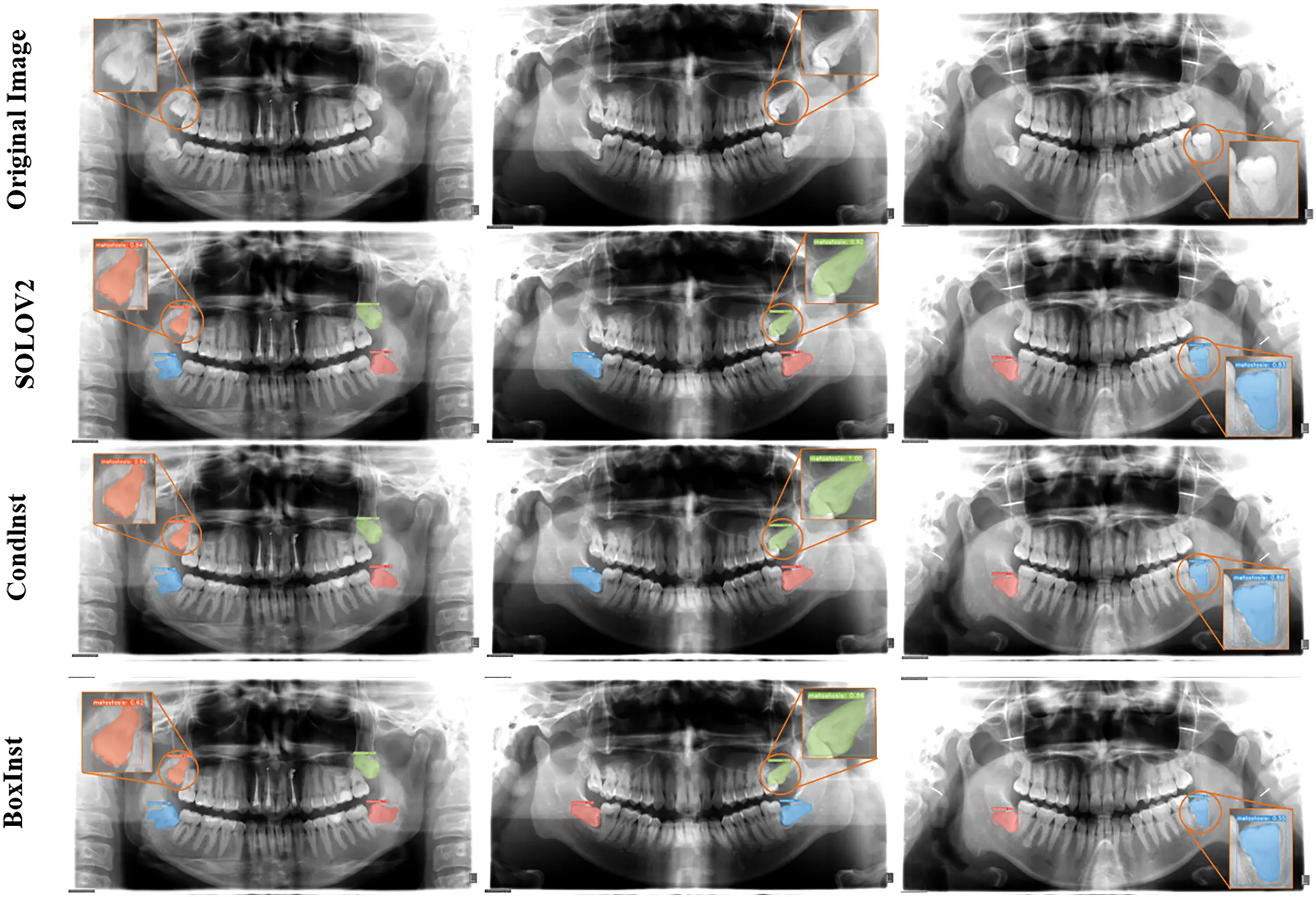 CMC | Free Full-Text | Teeth YOLACT: An Instance Segmentation Model ...
