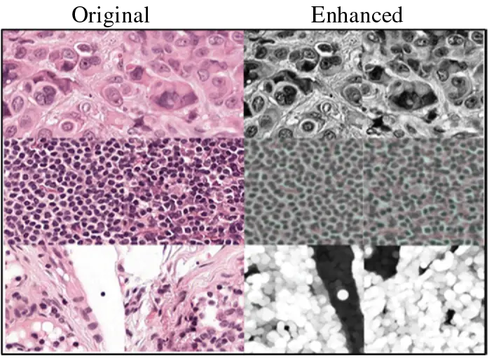 CMC | Free Full-Text | Salient Features Guided Augmentation for ...