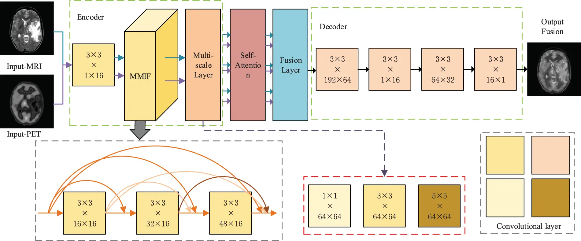 CMC | Free Full-Text | MMIF: Multimodal Medical Image Fusion Network Based on Multi-Scale Hybrid ...