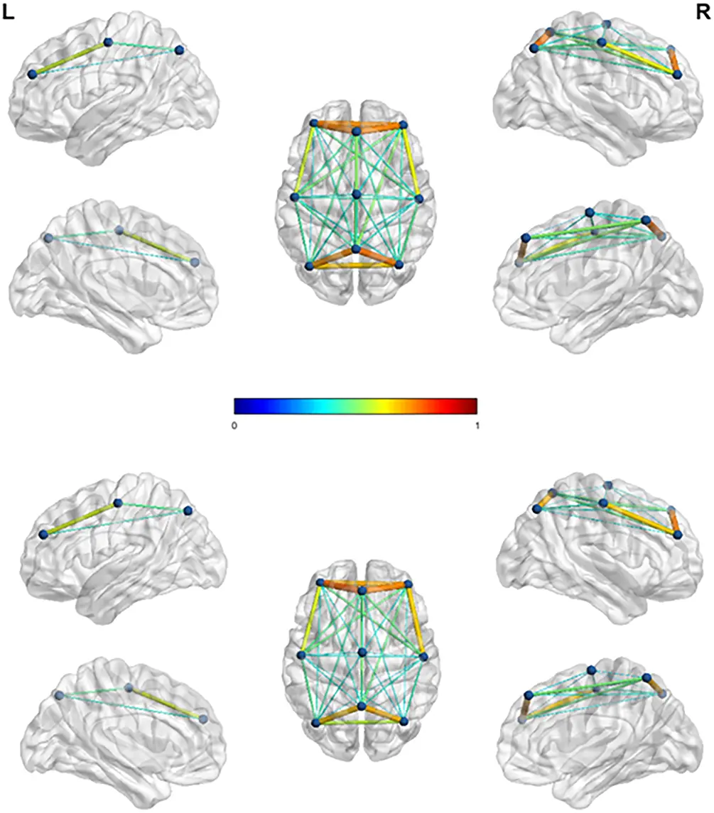 CMC | Free Full-Text | Classification Method of Lower Limbs Motor ...