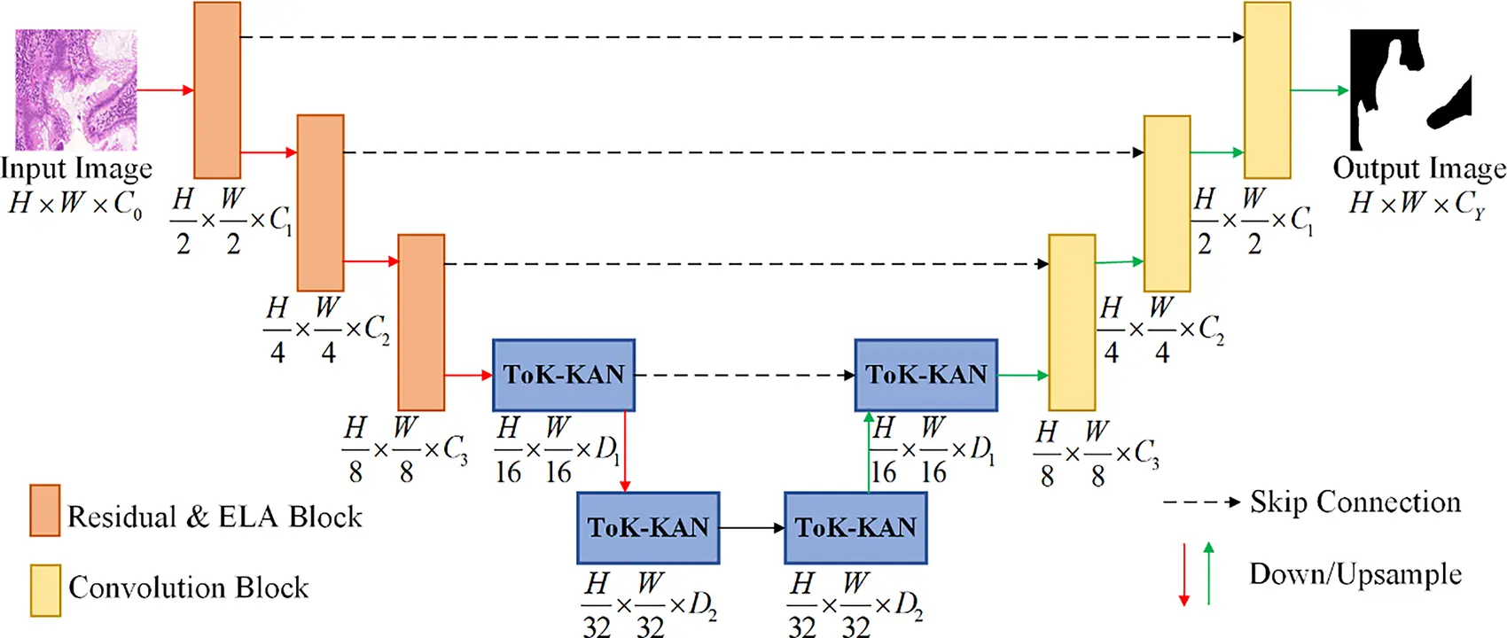 CMC | Free Full-Text | RE-UKAN: A Medical Image Segmentation Network ...