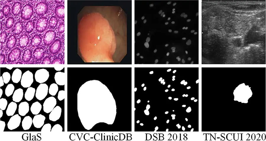 CMC | Free Full-Text | RE-UKAN: A Medical Image Segmentation Network ...