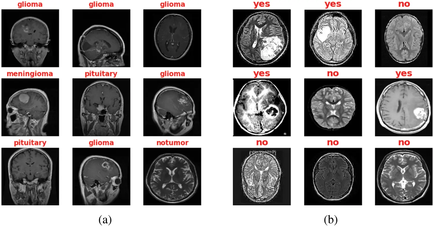 CSSE | Free Full-Text | An Improved Deep Structure for Accurately Brain Tumor Recognition