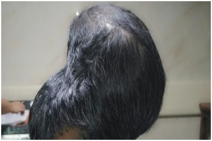 CSSE | Free Full-Text | An Effective Diagnosis System for Brain Tumor Detection and Classification