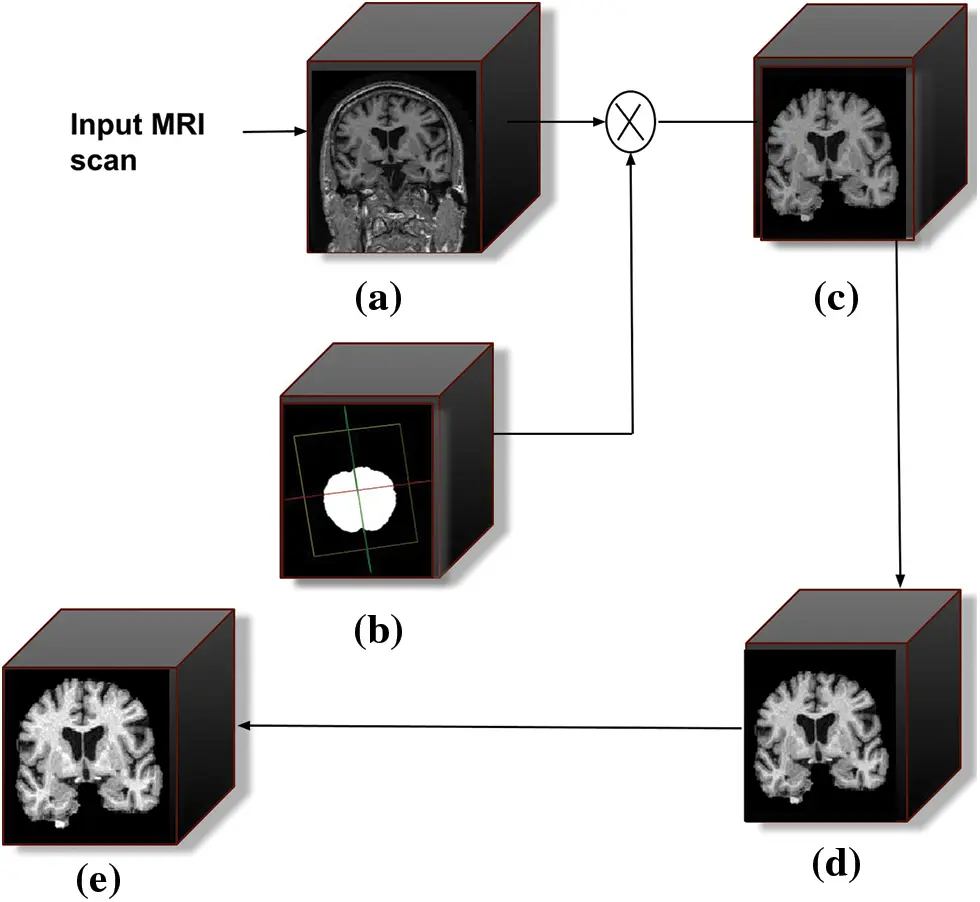 CSSE | Free Full-Text | An Efficient 3D CNN Framework with Attention Mechanisms for Alzheimer’s ...