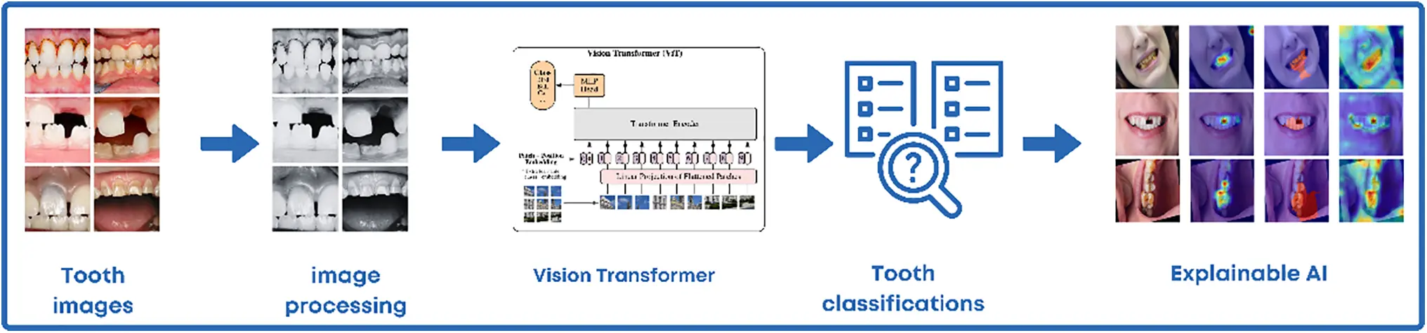 CSSE | Free Full-Text | Explainable Transformer-Based Approach for Dental Disease Prediction