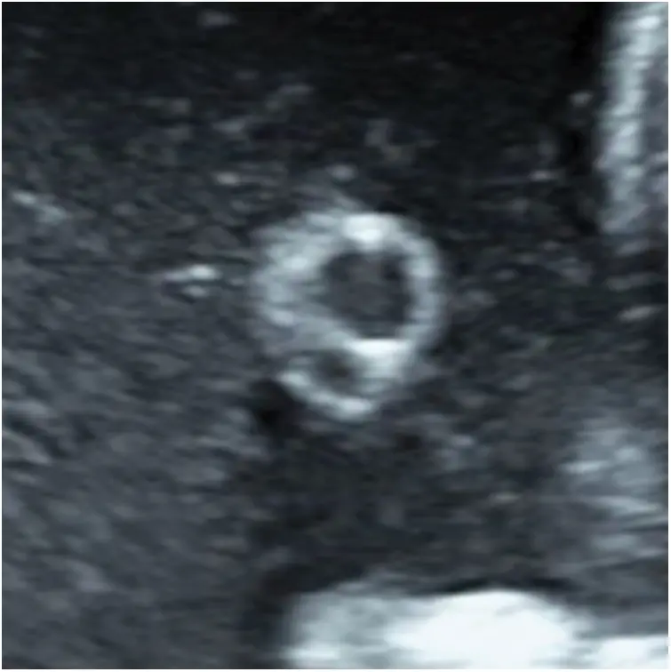 MCB | Free Full-Text | Current Perspectives on Umbilical Cord ...