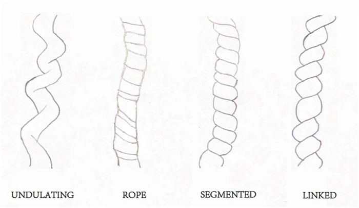hypercoiling umbilical cord