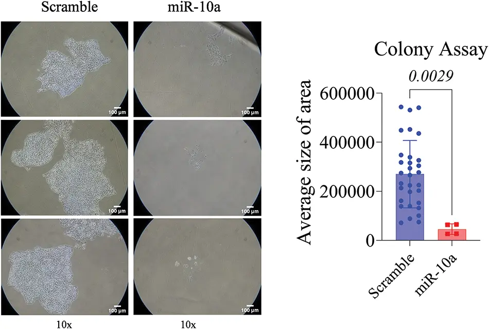 OR | Free Full-Text | Is miR-10a a tumor suppressor that modulates ...