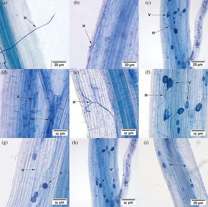 arbuscules and vesicles