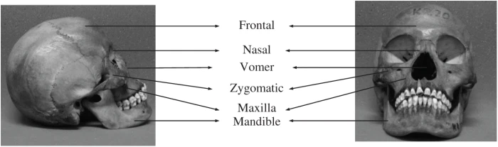 human skull differences