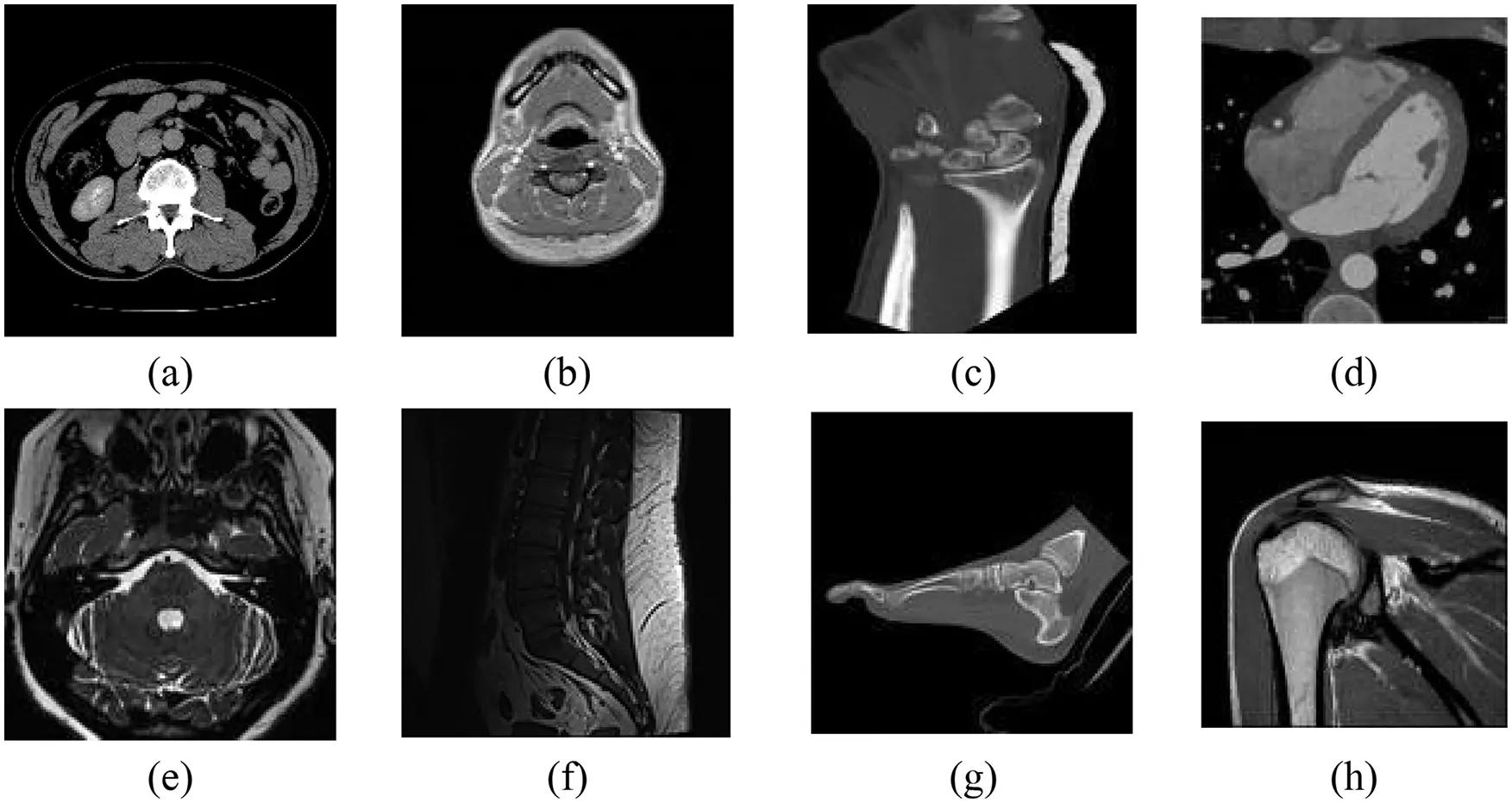 CMC | Free Full-Text | A Multi-Watermarking Algorithm for Medical ...
