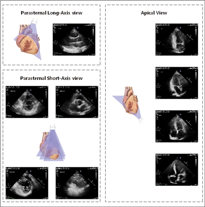 echo parasternal short axis view