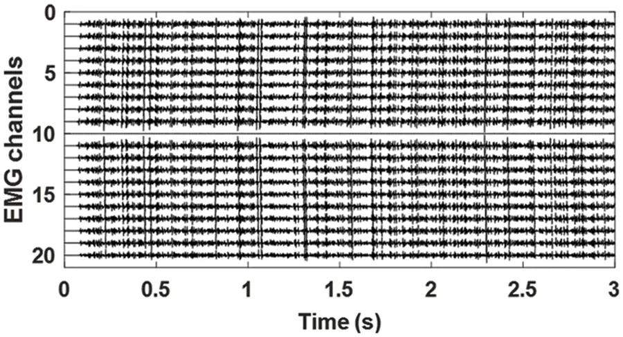 IASC | Free Full-Text | Automatic Detection of Outliers in Multi ...